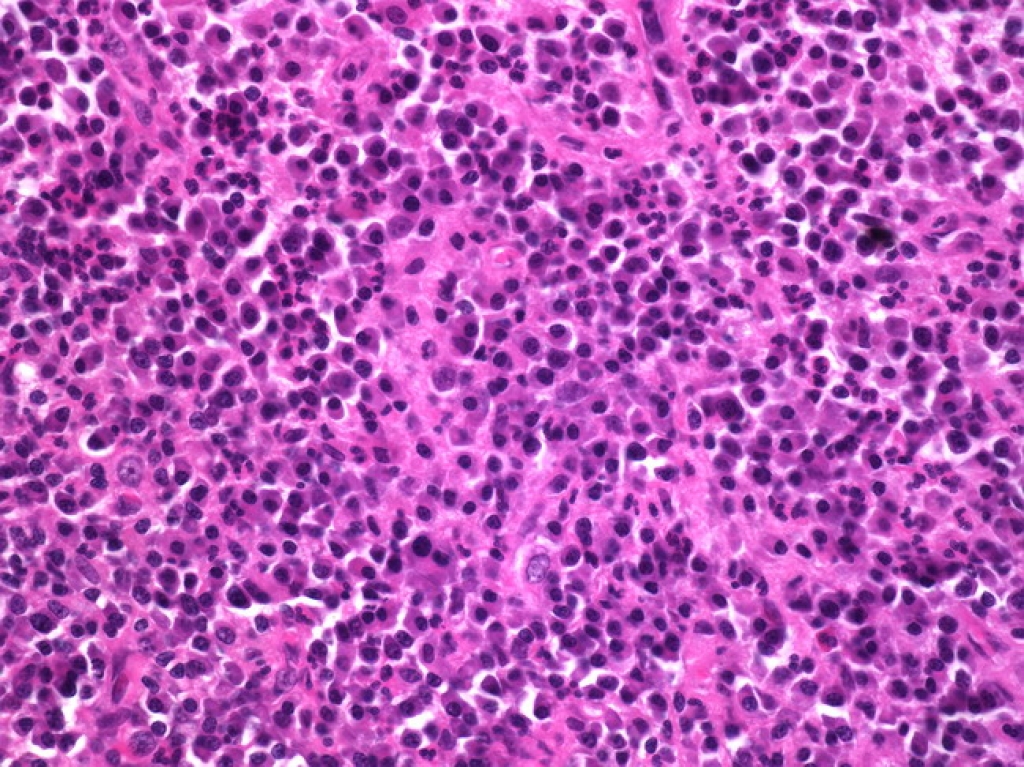 Vnetje jajčnikov – ooforitis | Bambino.si - Portal za nosečnice in dojenčke